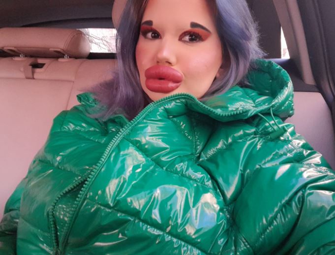 Andrea Ivanova [Biggest Lips] Wiki, Biography, Surgery, Age, Boyfriend ...
