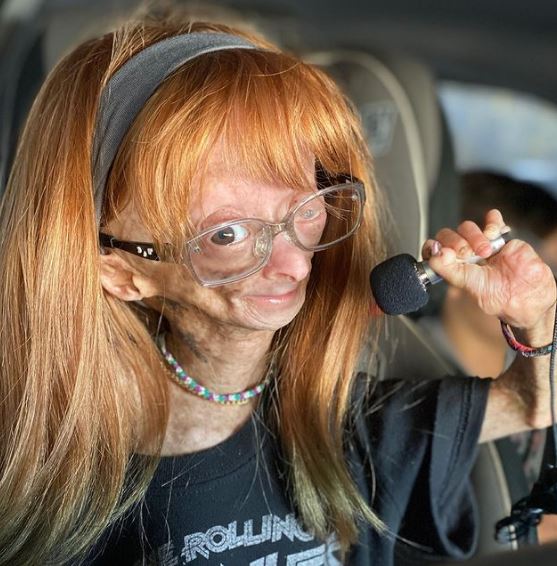 Who was Adalia Rose? Wiki, Biography, Net worth, Disease, Death ...