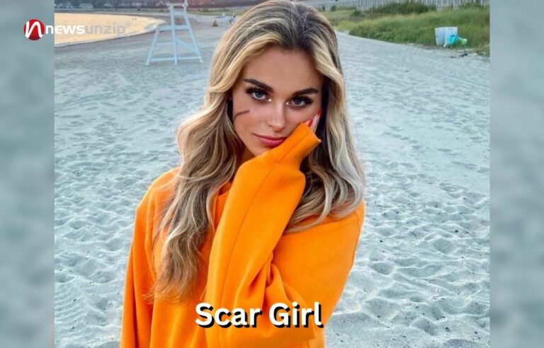 Who is Scar Girl? Wiki, Age, Height, Boyfriend, Family, Net Worth ...